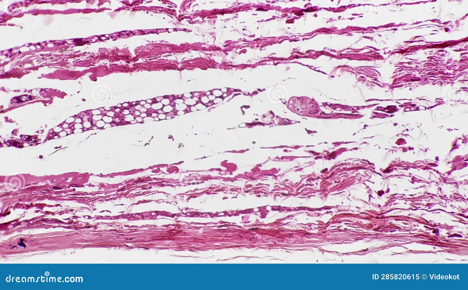 Microscopic Slide 100x of Human Skin Section Showing Thick Cornified ...