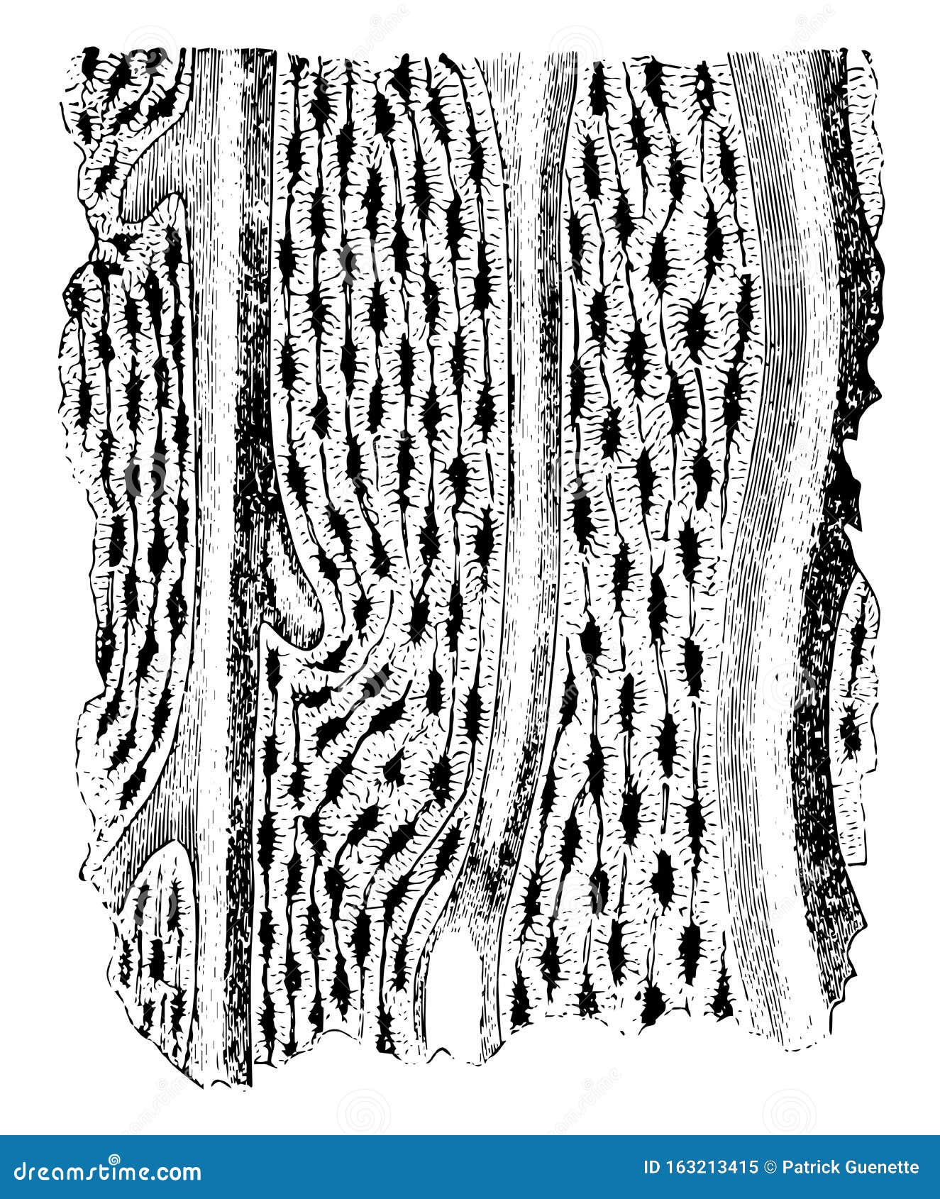 The Structure Of The Bone Marrow. Infographics. Vector Illustration ...