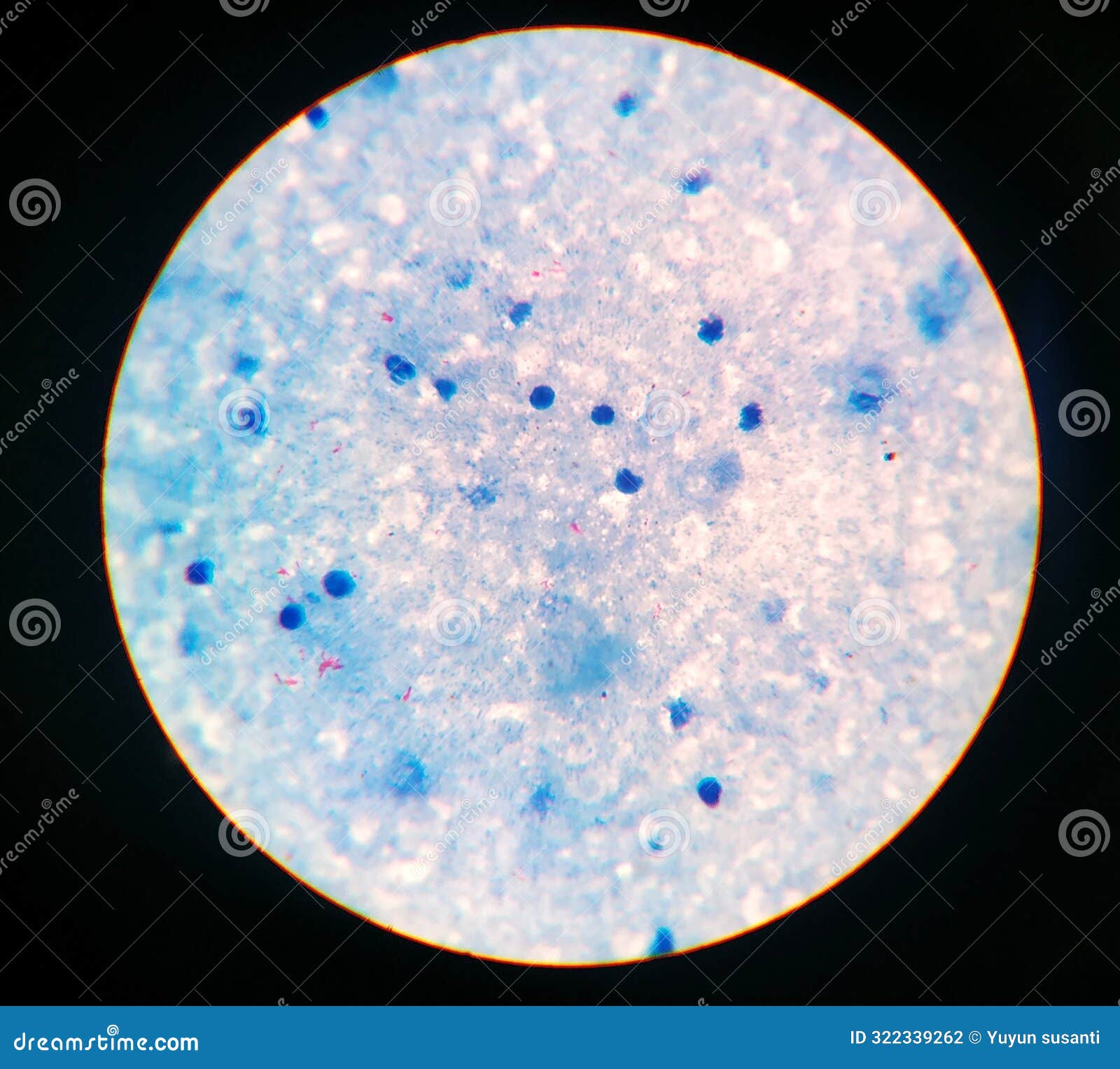 Microscopic of TB bacteria stock photo. Image of microscopic - 322339262