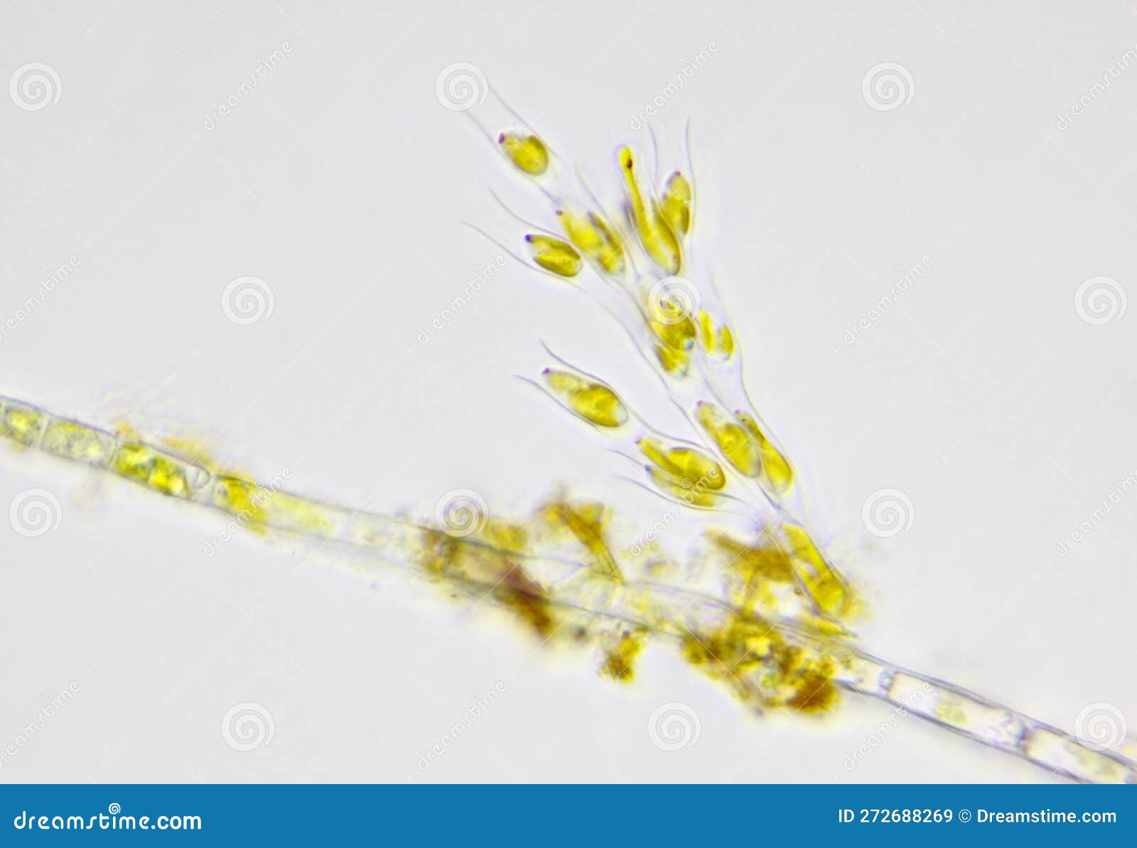 Microscopic View of Algae Colony (Dinobryon) on Green Algae Filament ...