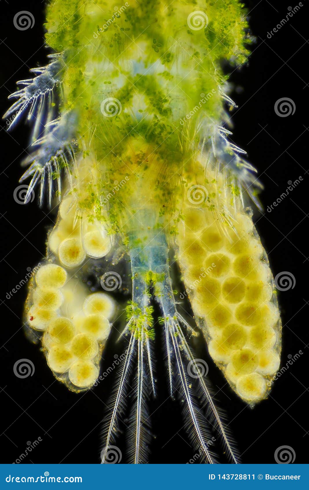 Microscopic View of Algae Covered Freshwater Copepod Cyclops. Back Part ...