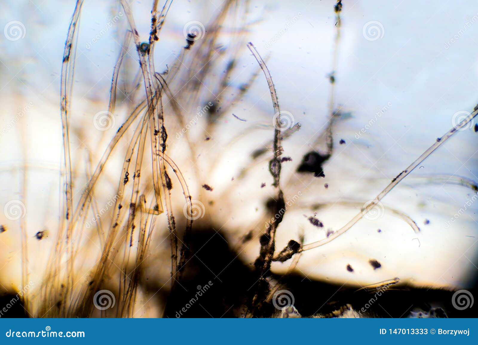 Microscopic View of Aspergillus Fungi Hyphae Stock Image - Image of ...