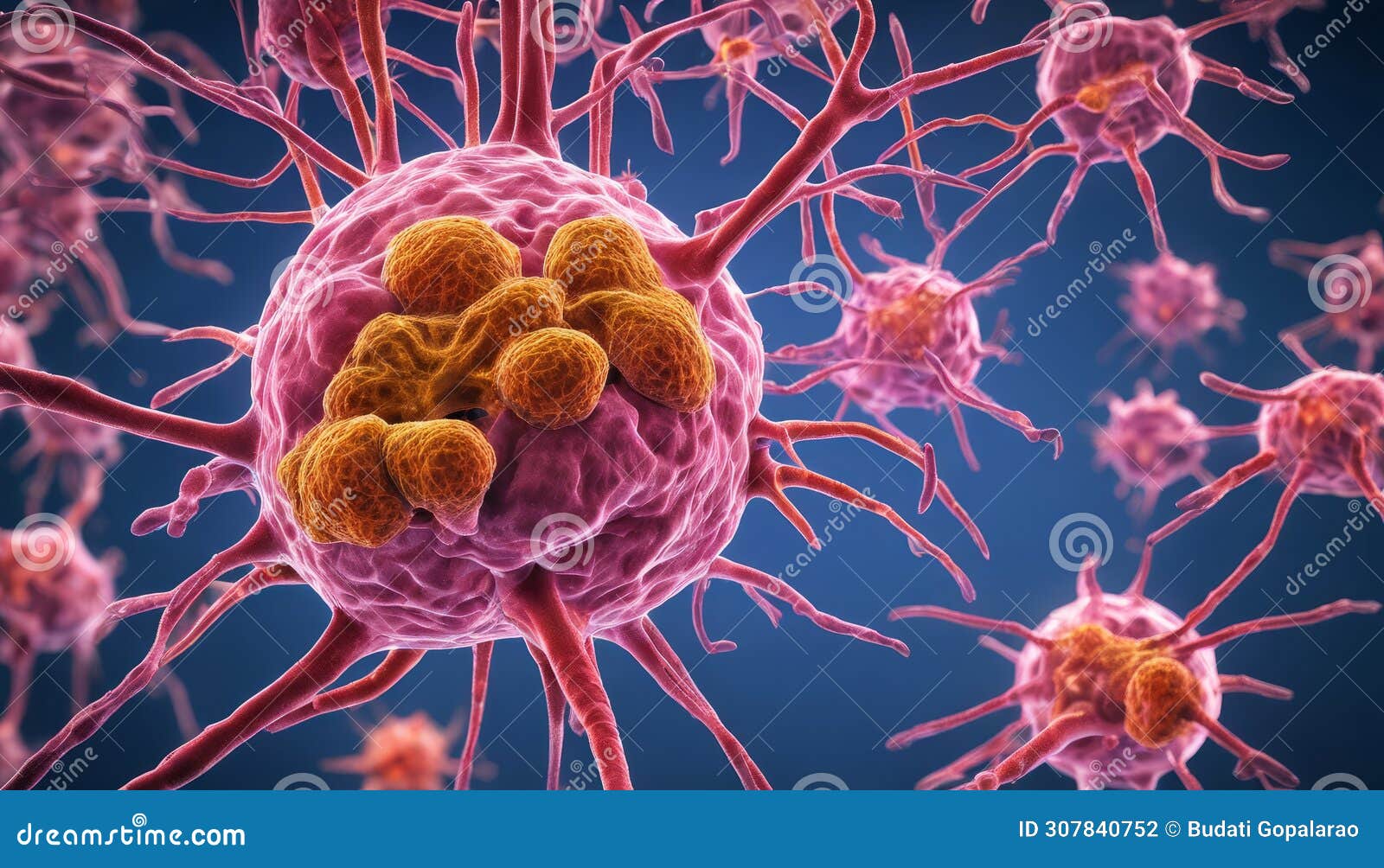 Microscopic View of a Cancer Cell with Multiple Nuclei, Highlighting ...