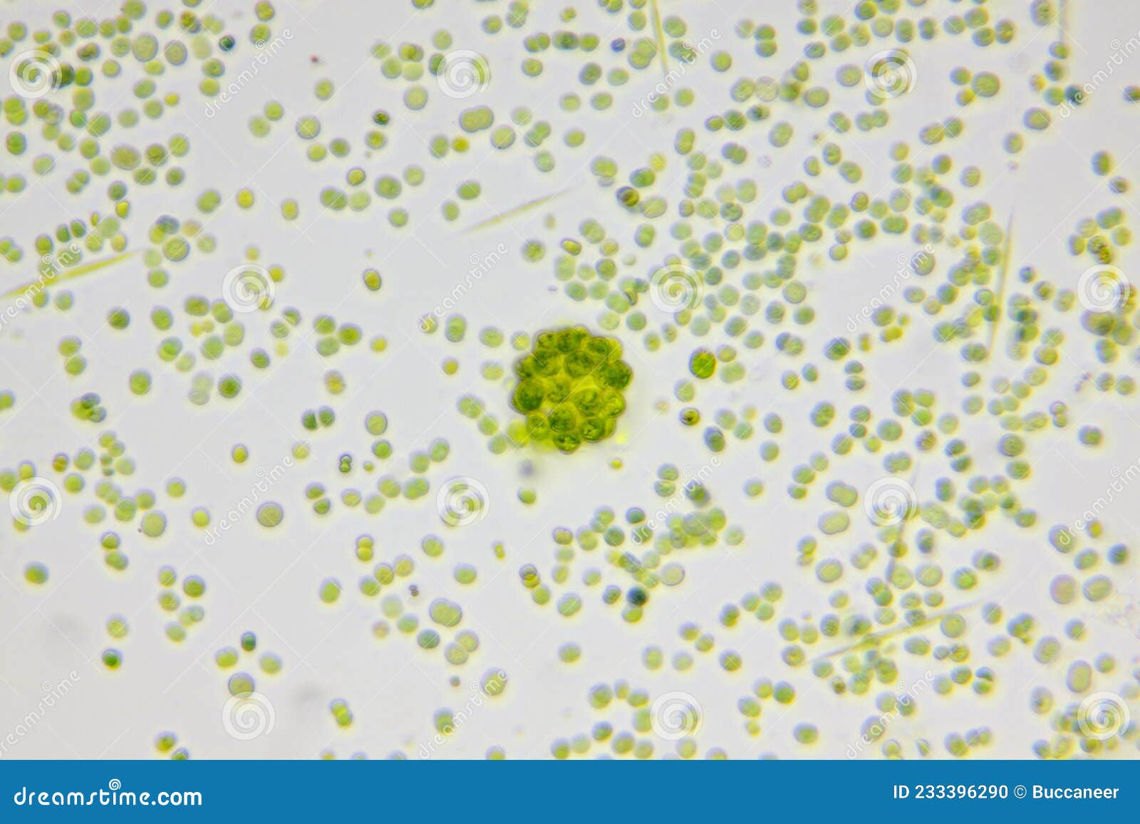 Microscopic View Of Colonial Green Algae Coelastrum Between Single-cell ...