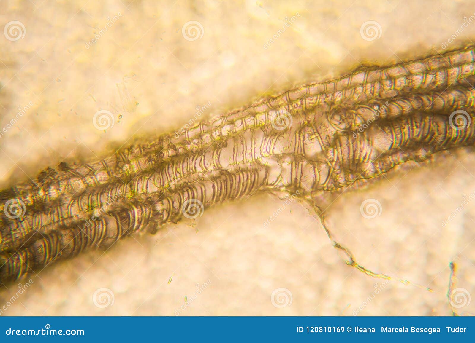 Microscopic View and Details of Rotten Tulip Stem Stock Image - Image ...