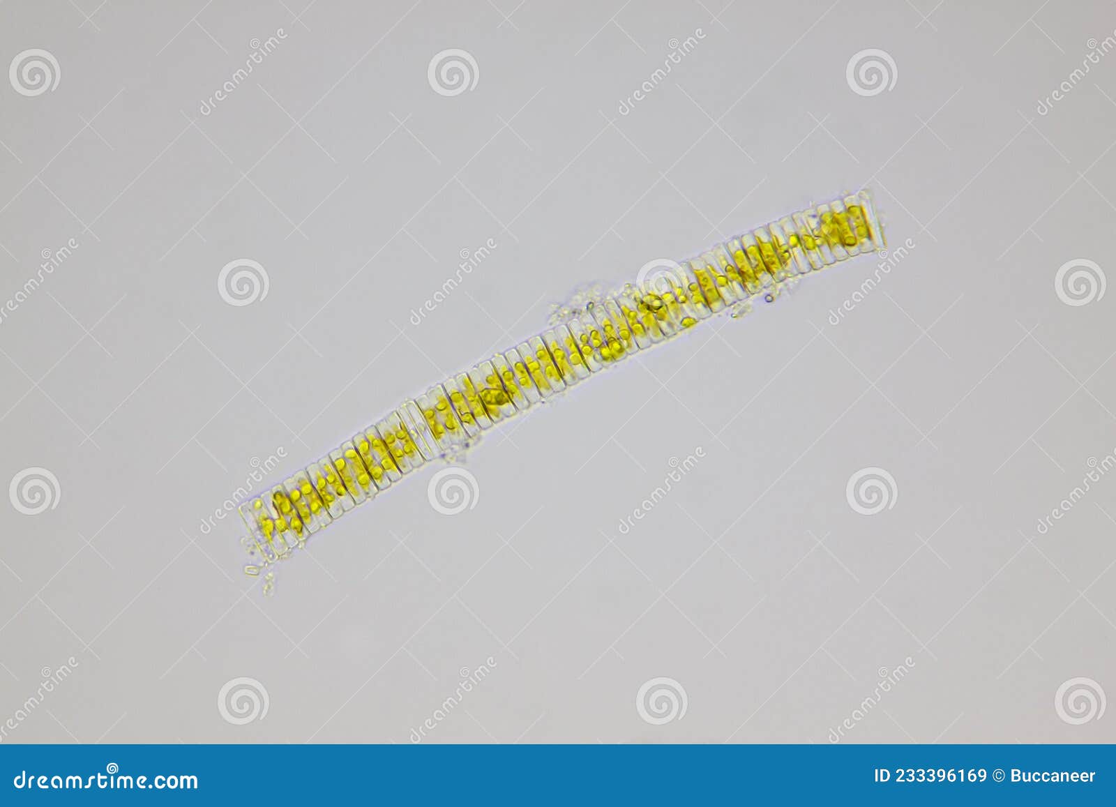 Microscopic View Of Algae Covered Freshwater Copepod Cyclops Royalty ...