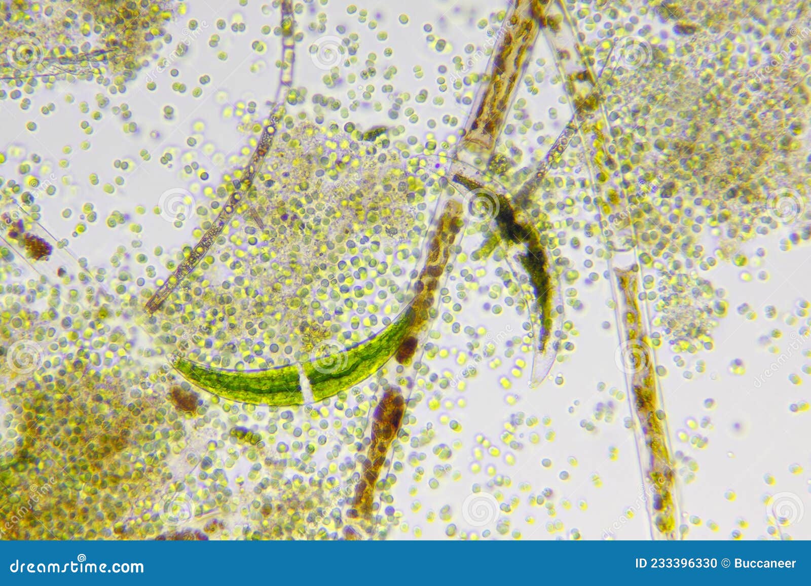 Microscopic View of Different Types of Algae Stock Photo - Image of ...