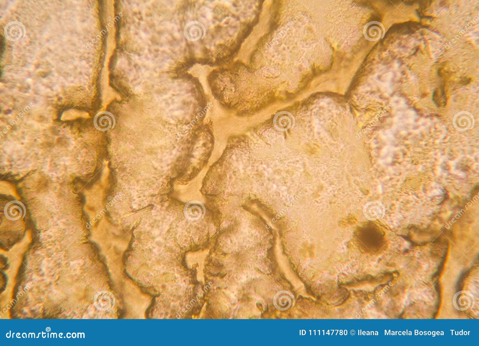 Microscopic View of Dirty Water Drying Stock Photo - Image of ...