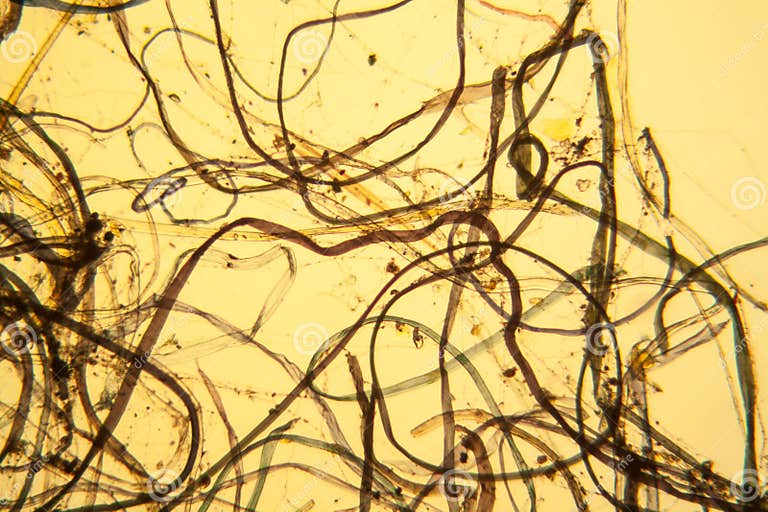 Microscopic view of dust stock photo. Image of pollen - 111148186