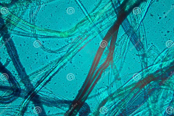 Microscopic view of dust stock image. Image of illness - 111147121