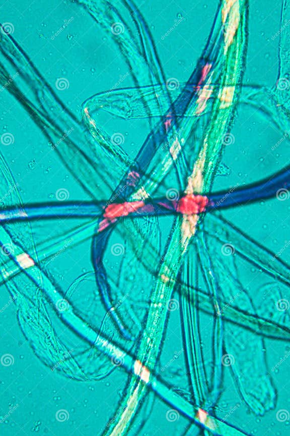 Microscopic view of dust stock photo. Image of microbiology - 111147140