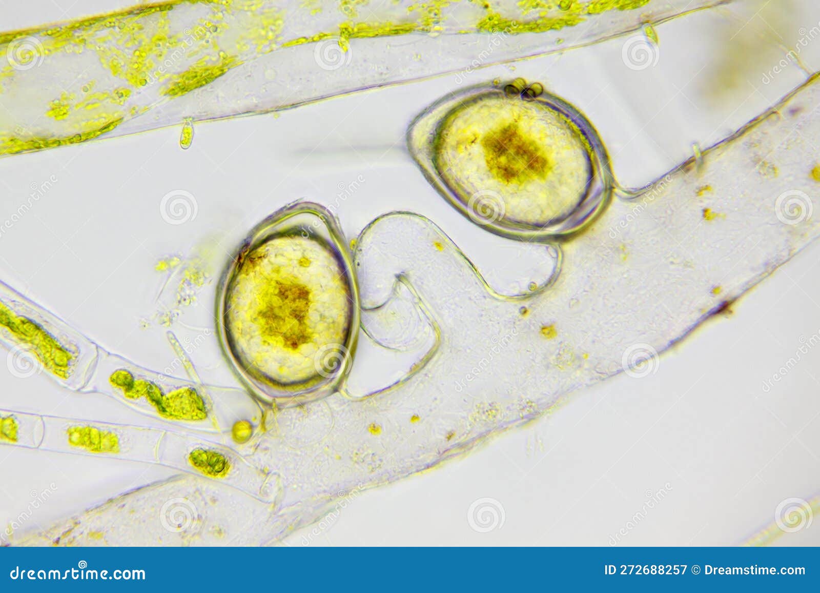 Microscopic View of Freshwater Algae Filament at Propagation Stage ...