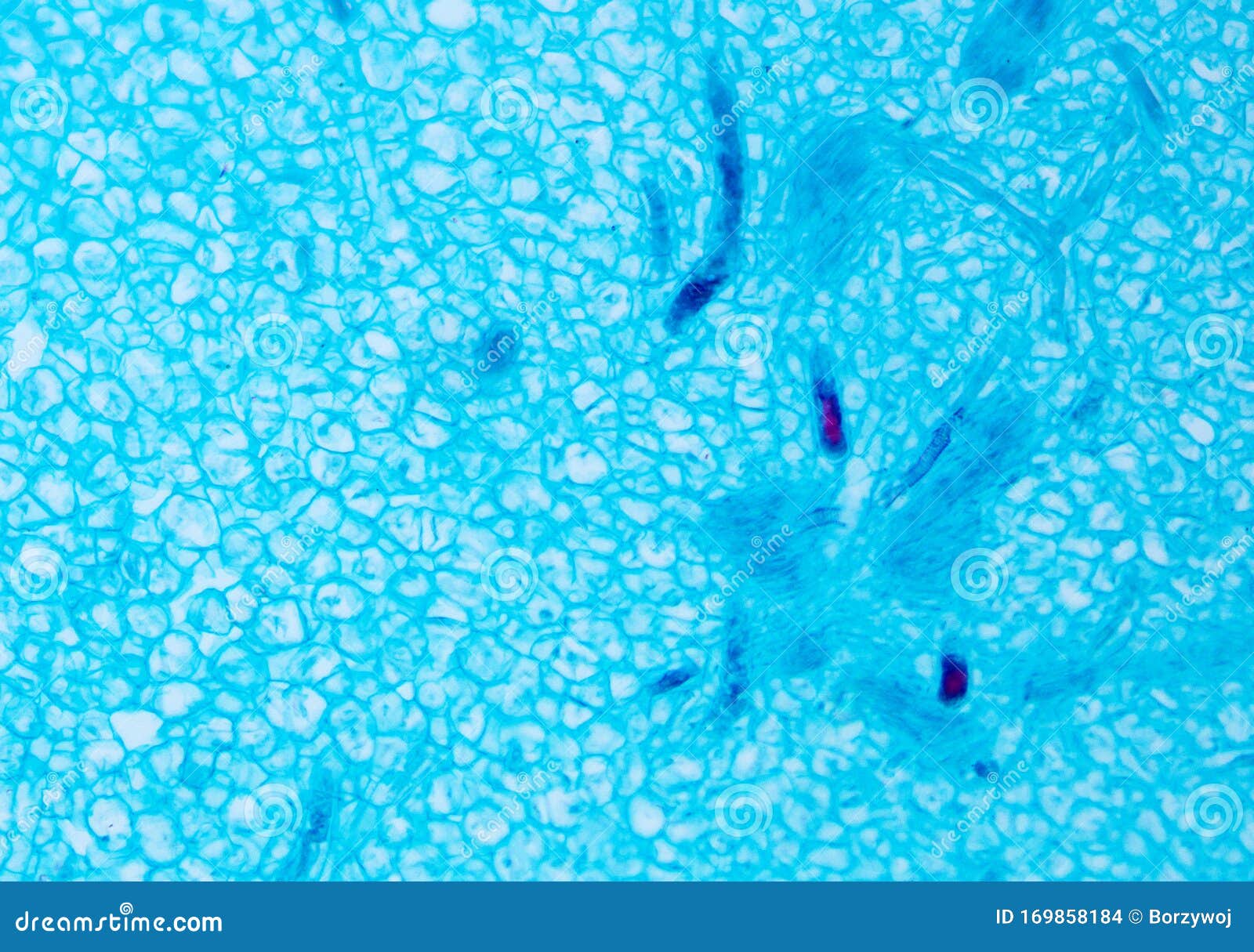 Transverse Section Of Pine Wood Under Microscope Royalty-Free Stock ...
