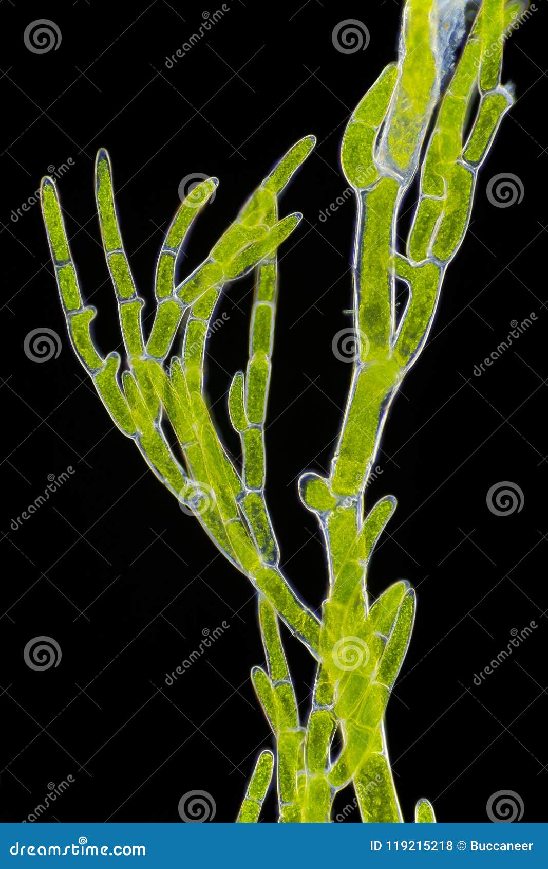 Cladophora Algae Under Microscope