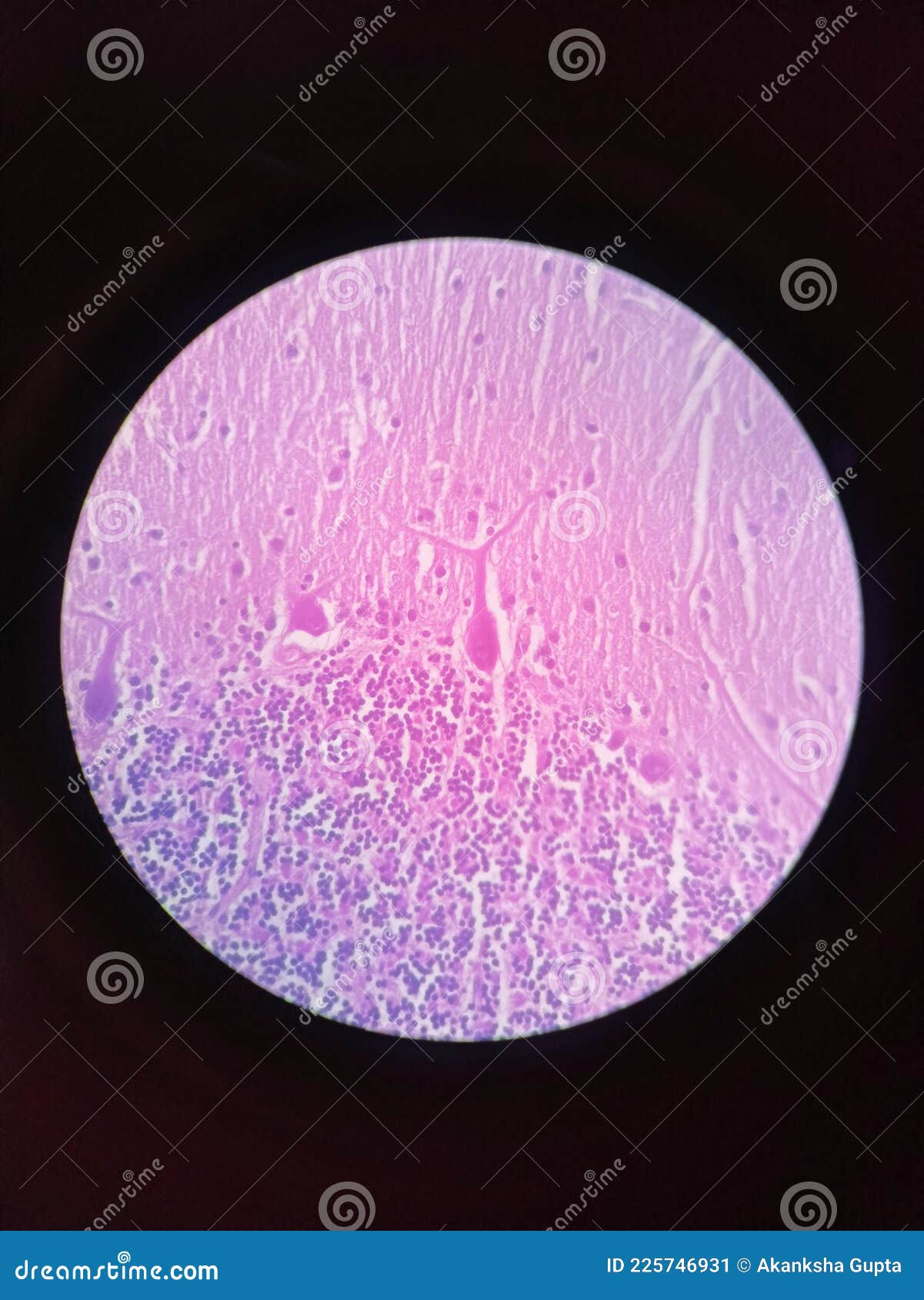 MICROSCOPIC VIEW of HUMAN CEREBELLUM Stock Image - Image of microscopic ...