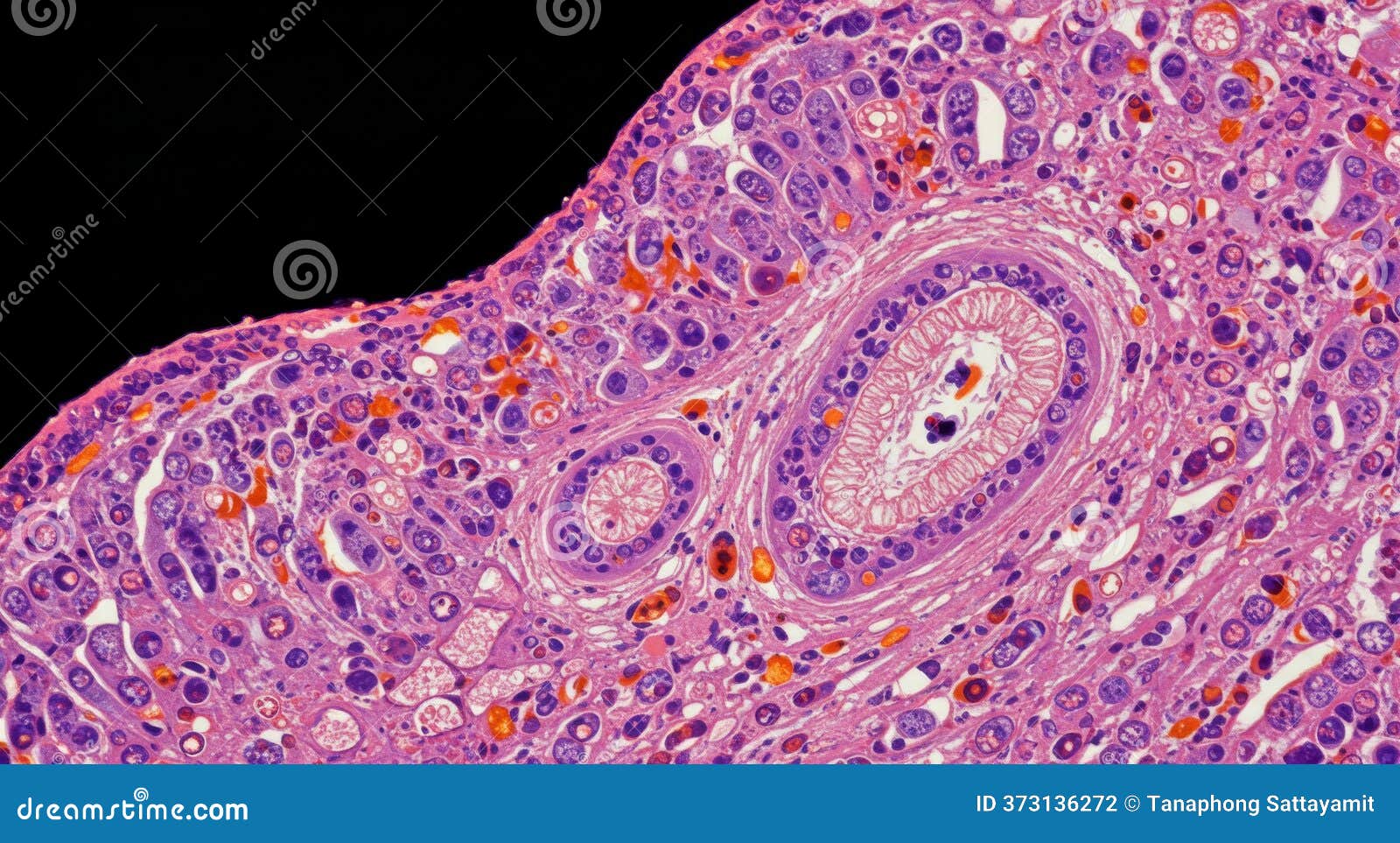 Microscopic View Of Human Lymph Node Cortex Medulla And Follicles ...