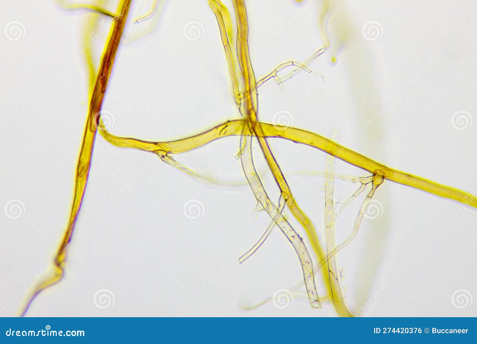 Microscopic View of Moss Rhizoids Stock Photo - Image of nature ... Microscopic View of Moss Rhizoids Stock Photo - Image of nature ...