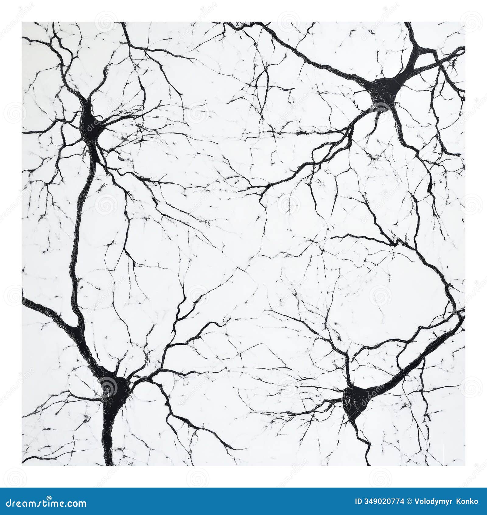 Microscopic View of Neural Network with Branching Dendrites in Black ...