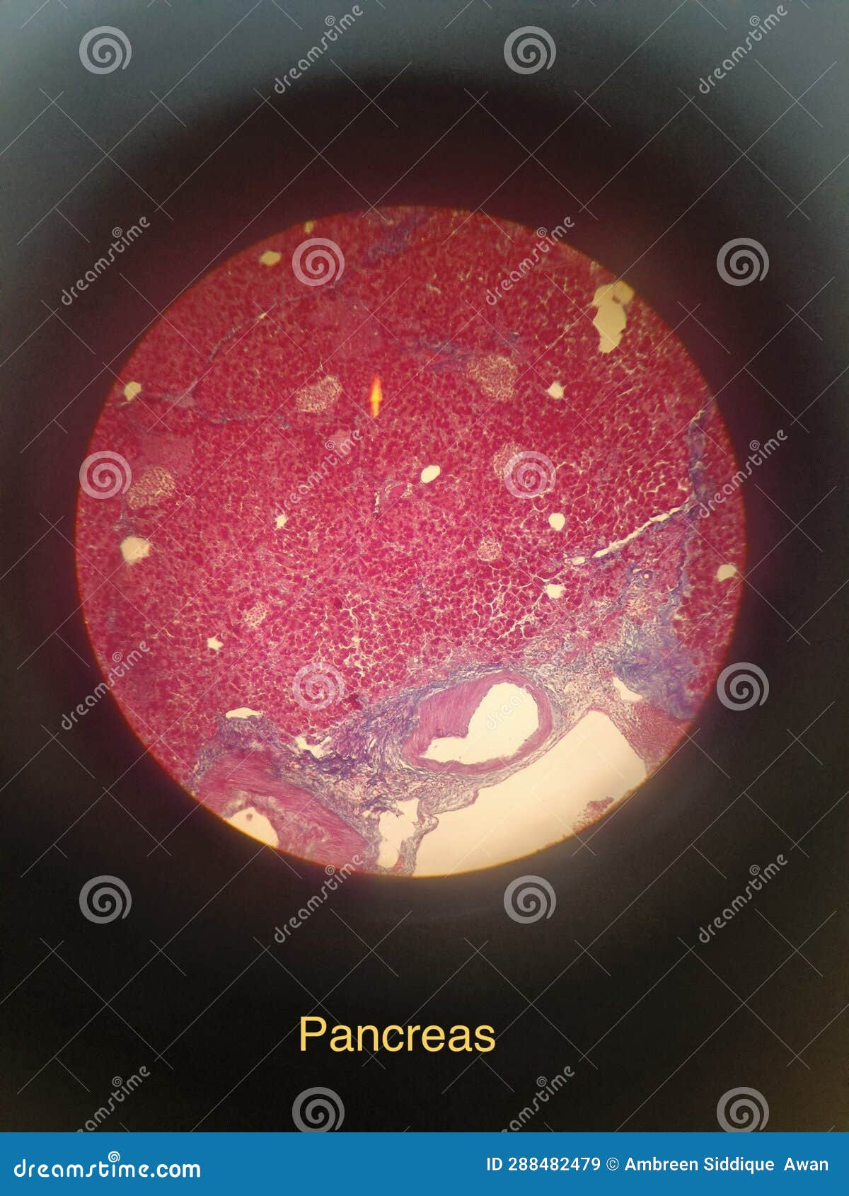 Microscopic View of Pancreas Stock Image - Image of captured, work ...