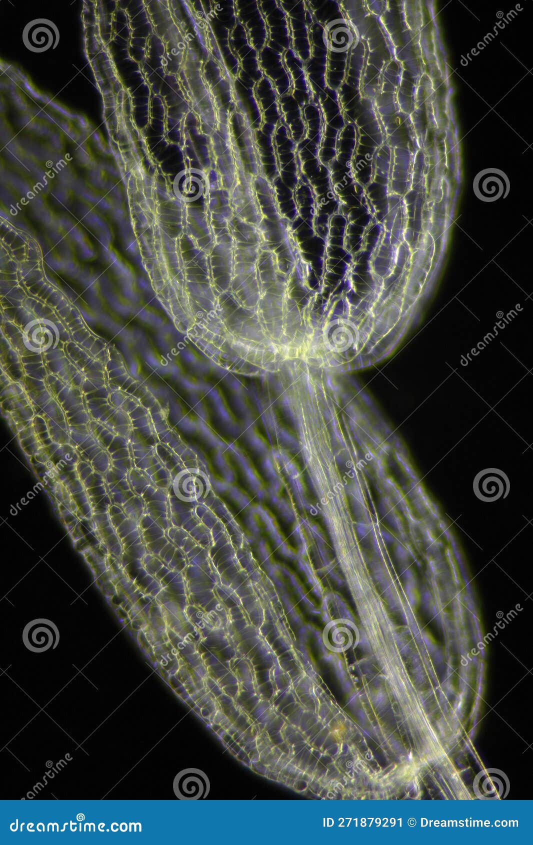 Microscopic View Of Peat Moss (Sphagnum) Detail Stock Image ... Microscopic View Of Peat Moss (Sphagnum) Detail Stock Image ...