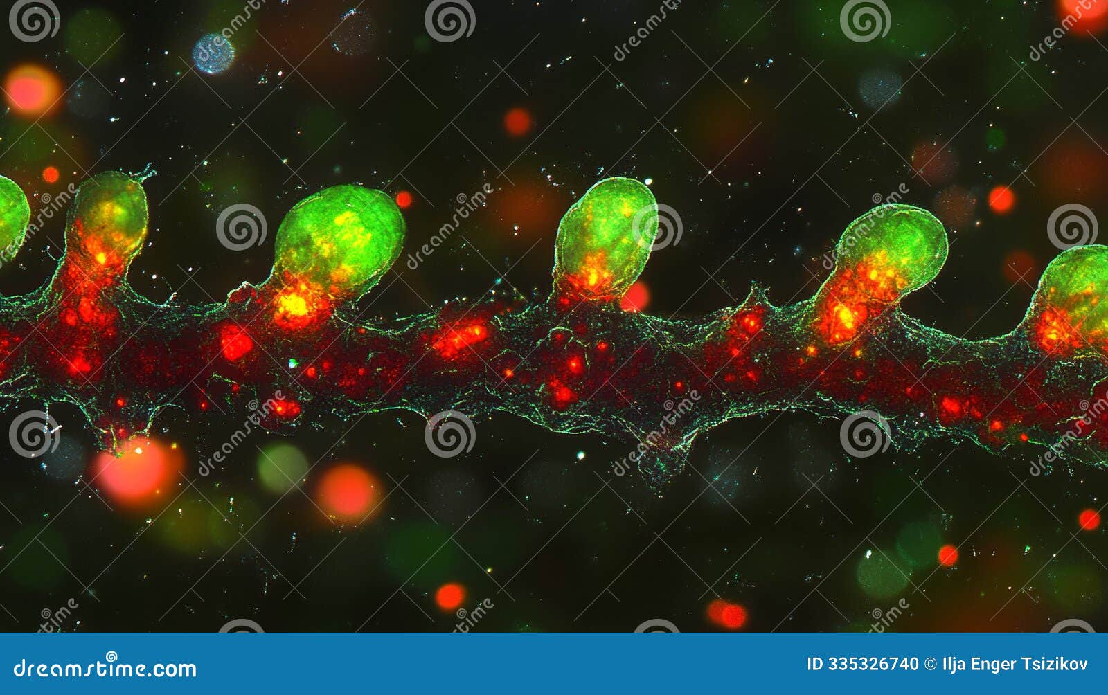 Microscopic View Of Plant Cells, Showing Chloroplasts And Cell Walls ... Microscopic View Of Plant Cells, Showing Chloroplasts And Cell Walls ...