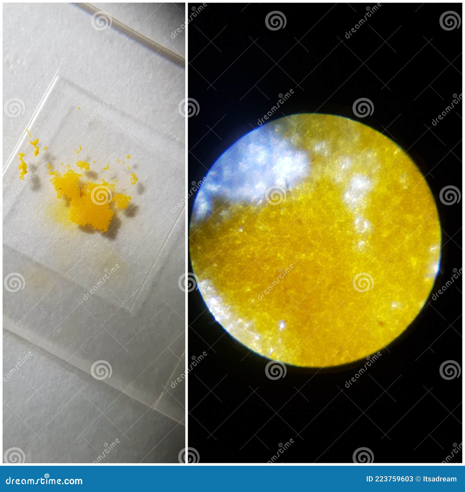 Microscopic View of the Pollen of Butternut Squash Stock Image - Image ...