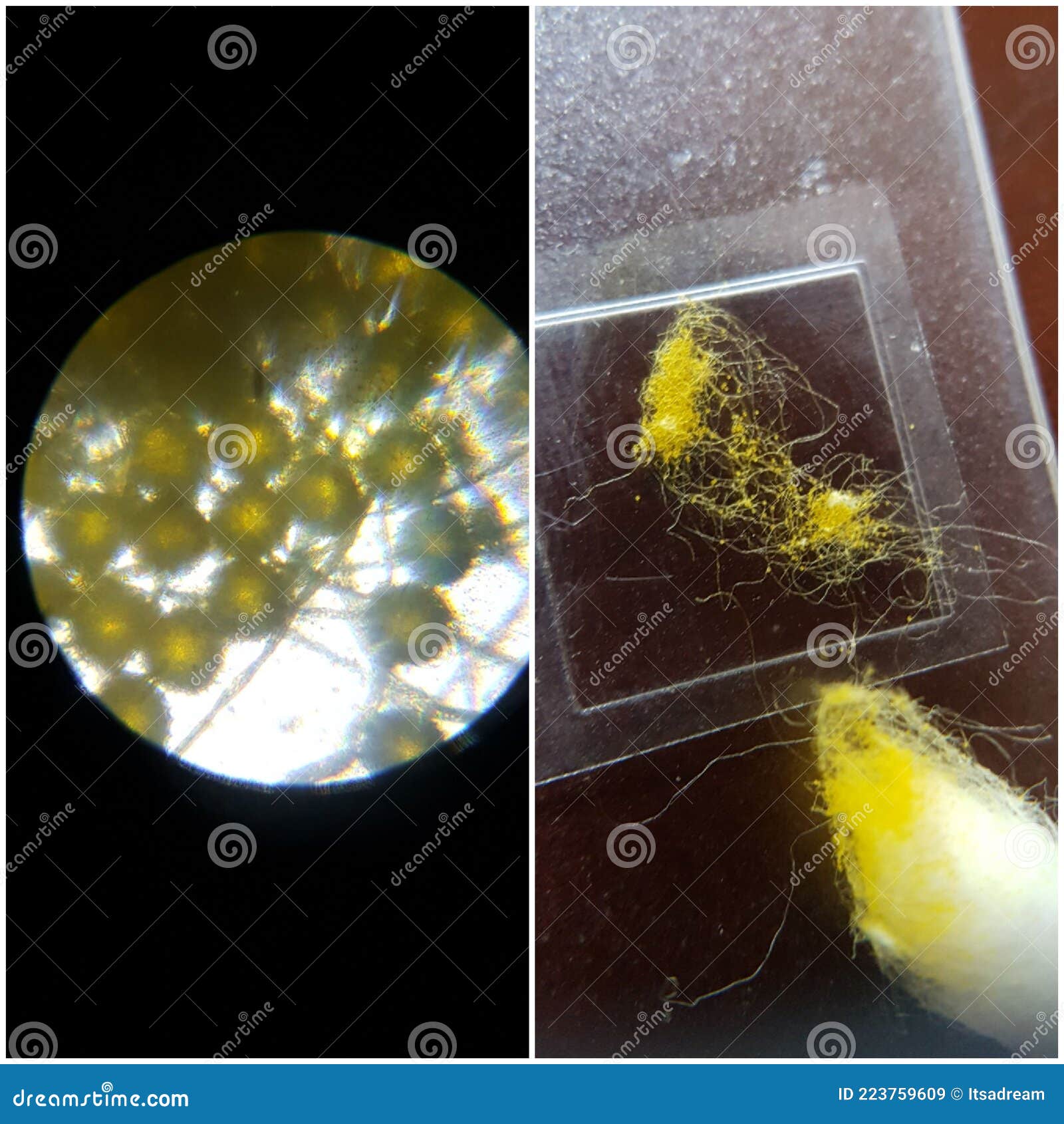 Microscopic View of the Pollen of Butternut Squash Stock Image - Image ...