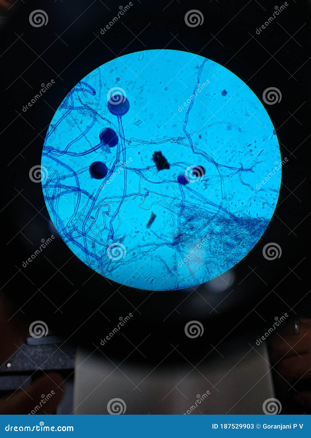 Microscopic View of Rhizopus Fungal Species Stock Image - Image of ...