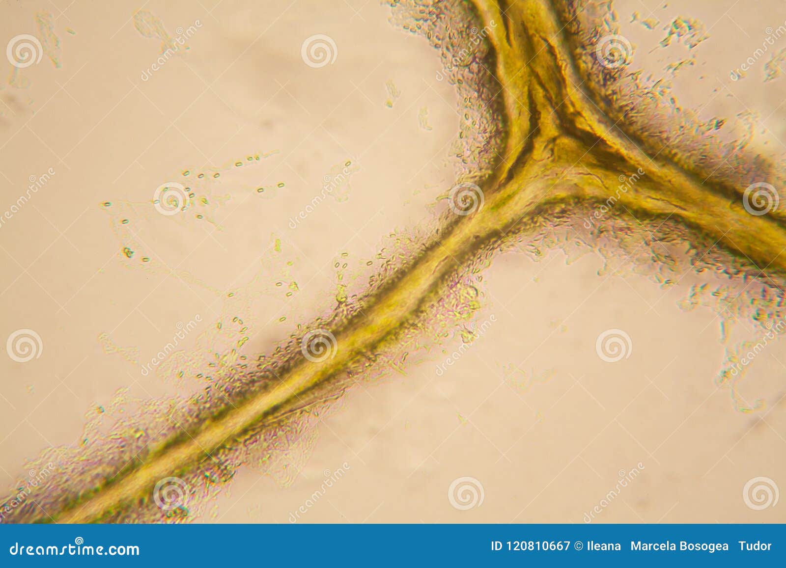 Microscopic View of Rotten Tulip Stem Stock Image - Image of green ...