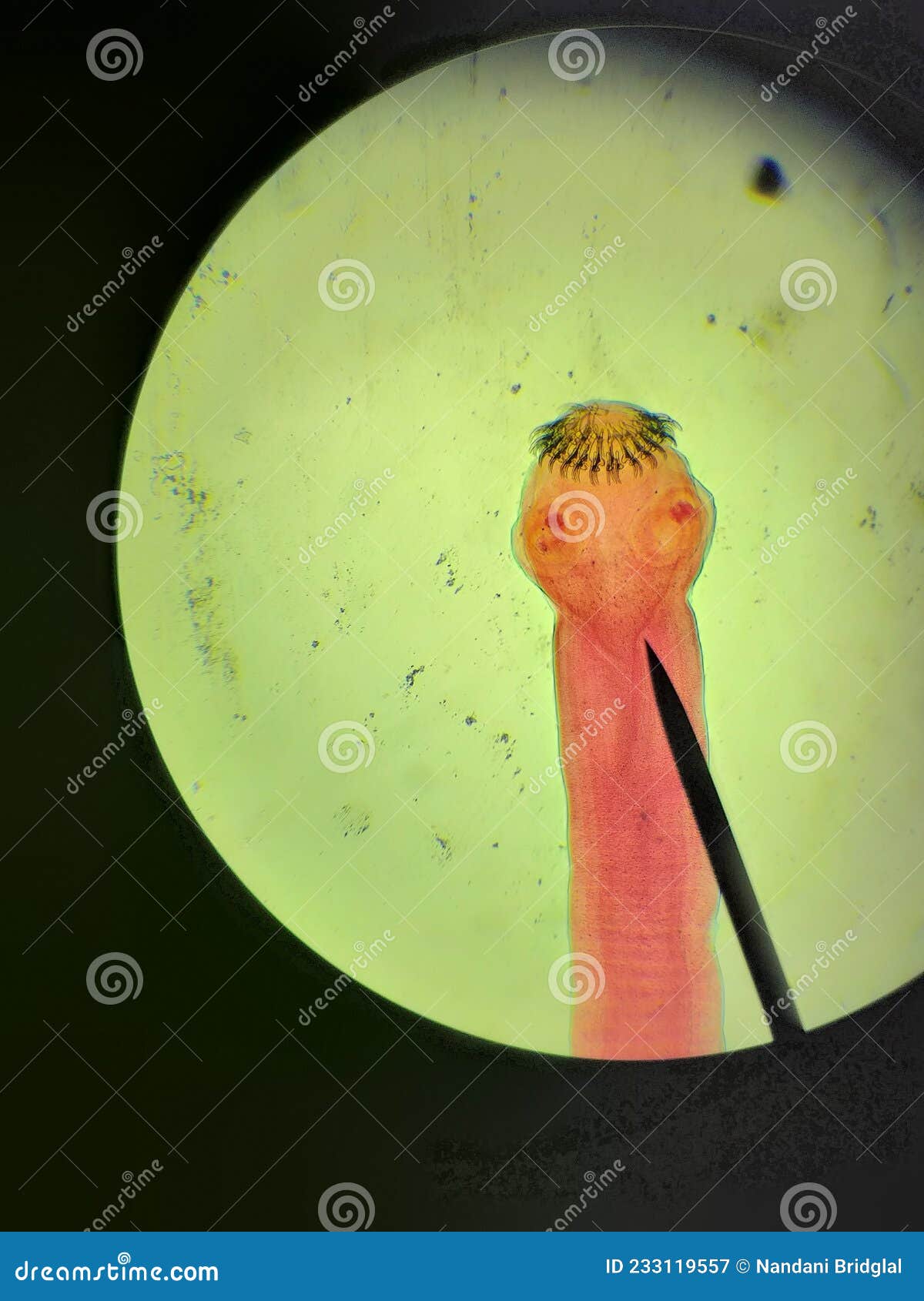 Microscopic View of Tapeworm Stock Image - Image of glass, medical ...