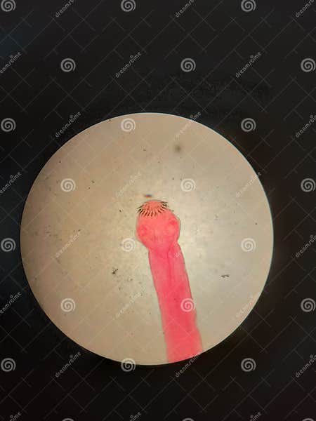 Microscopic View of Tapeworm Stock Image - Image of head, pink: 233119561