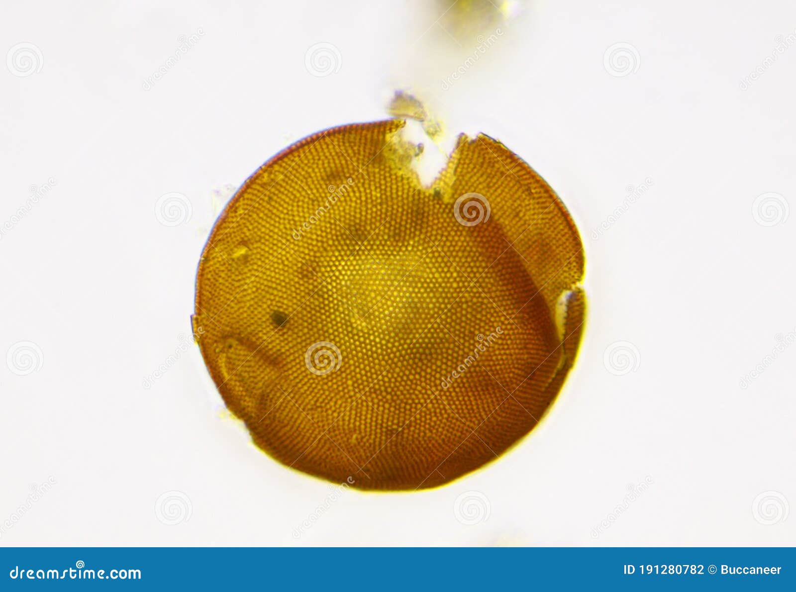 Microscopic View Of Testate Amoeba Arcella Shell With Visible External ...