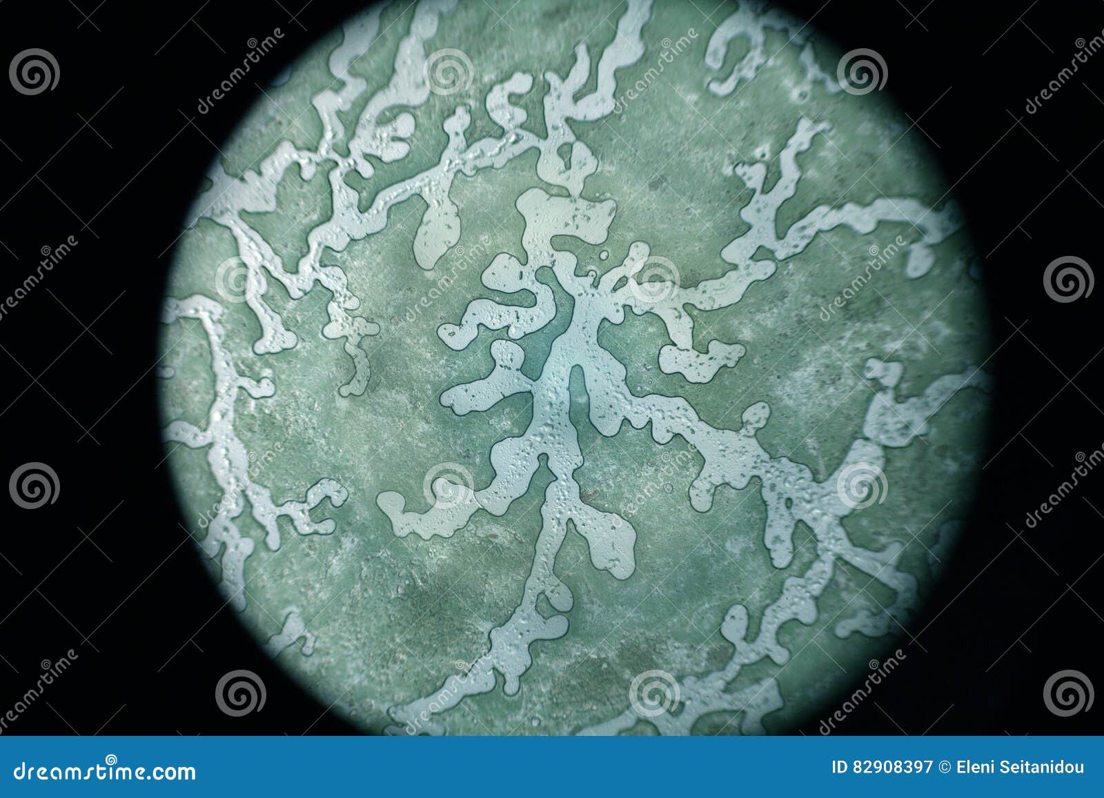 Microscopic view stock image. Image of anatomy, human - 82908397