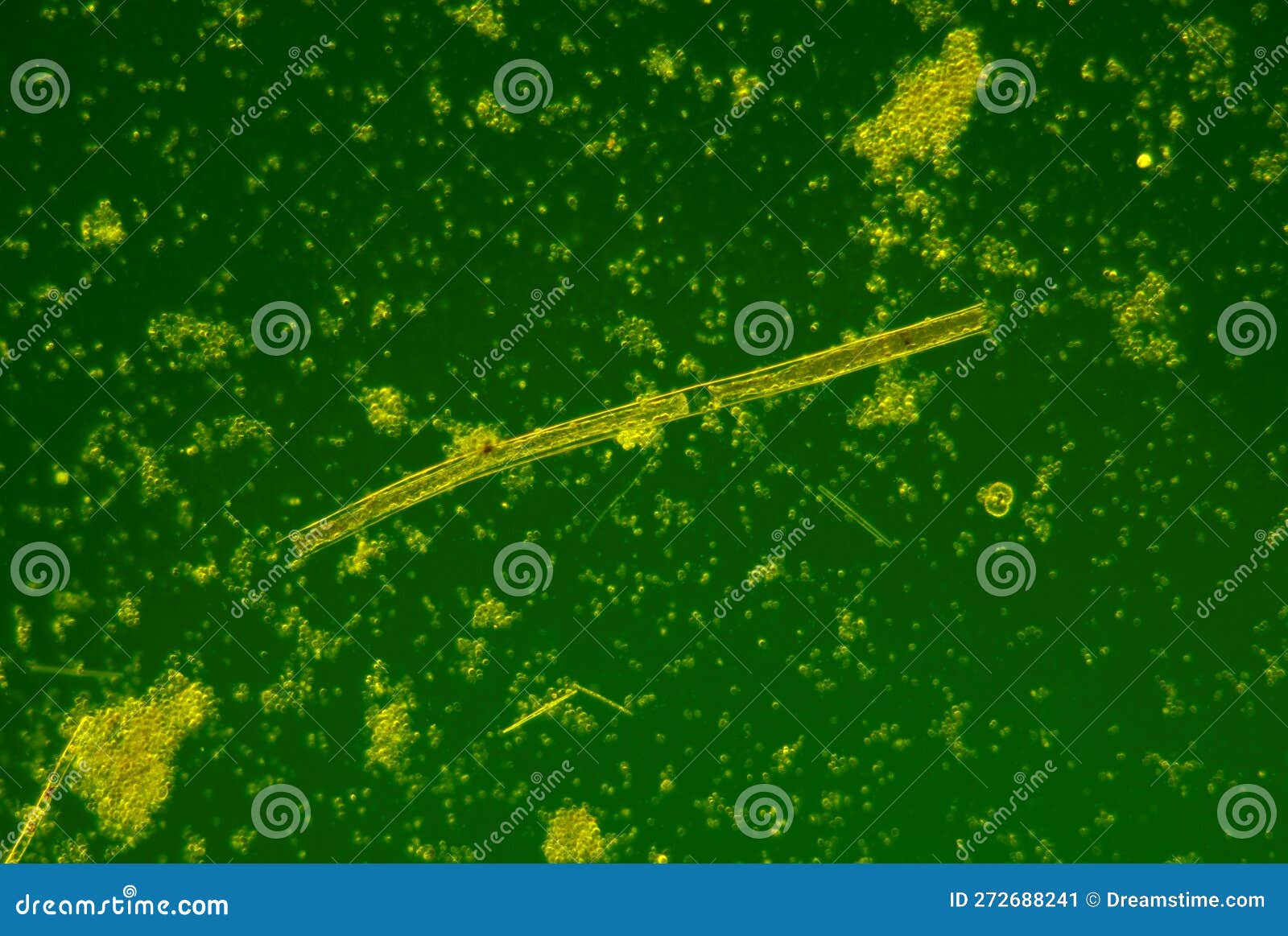 Microscopic View of Various Species of Planktonic Freshwater Algae ...