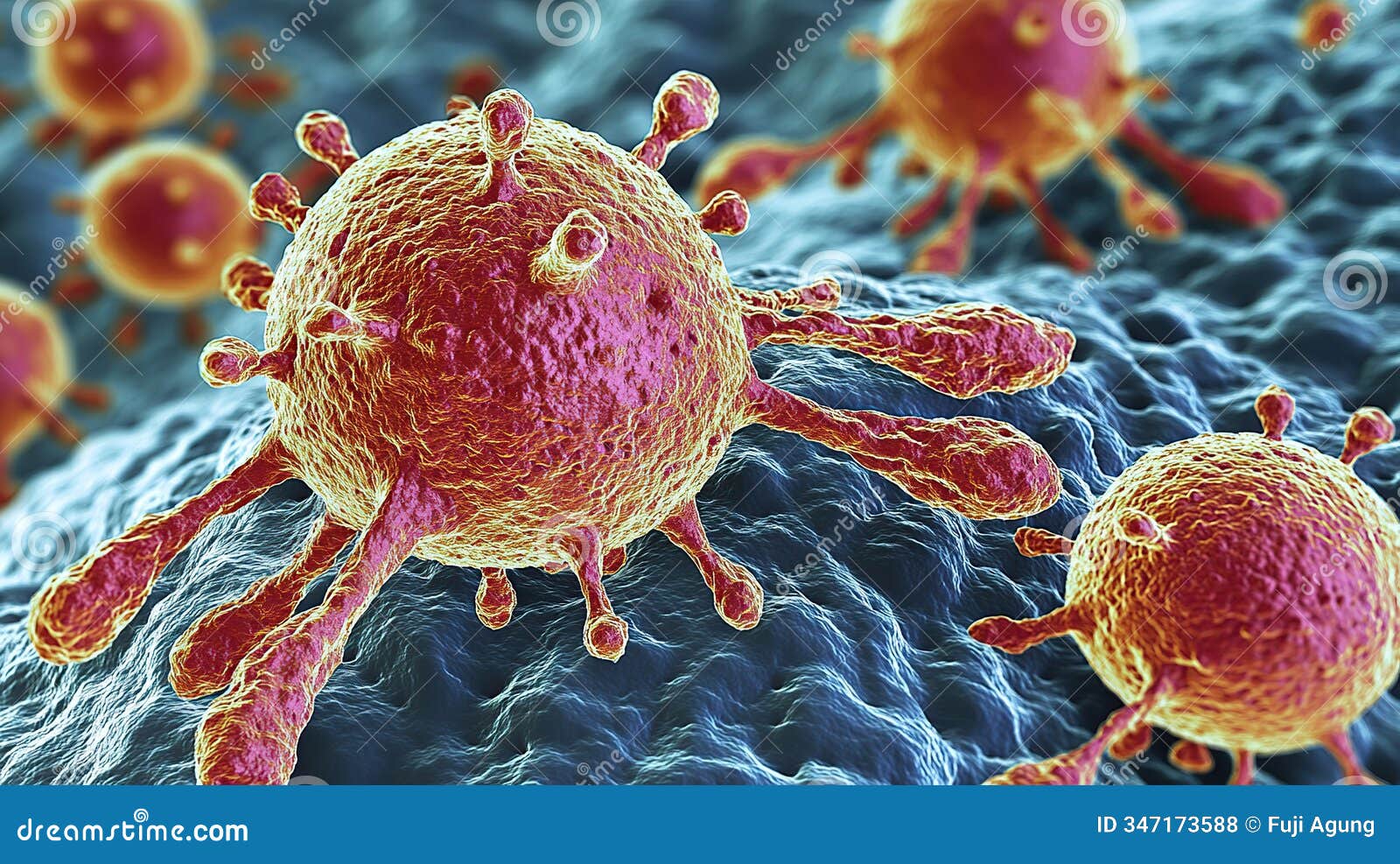 Viruses Infecting Neurons, Concept For Brain Infection, 3D Illustration ...