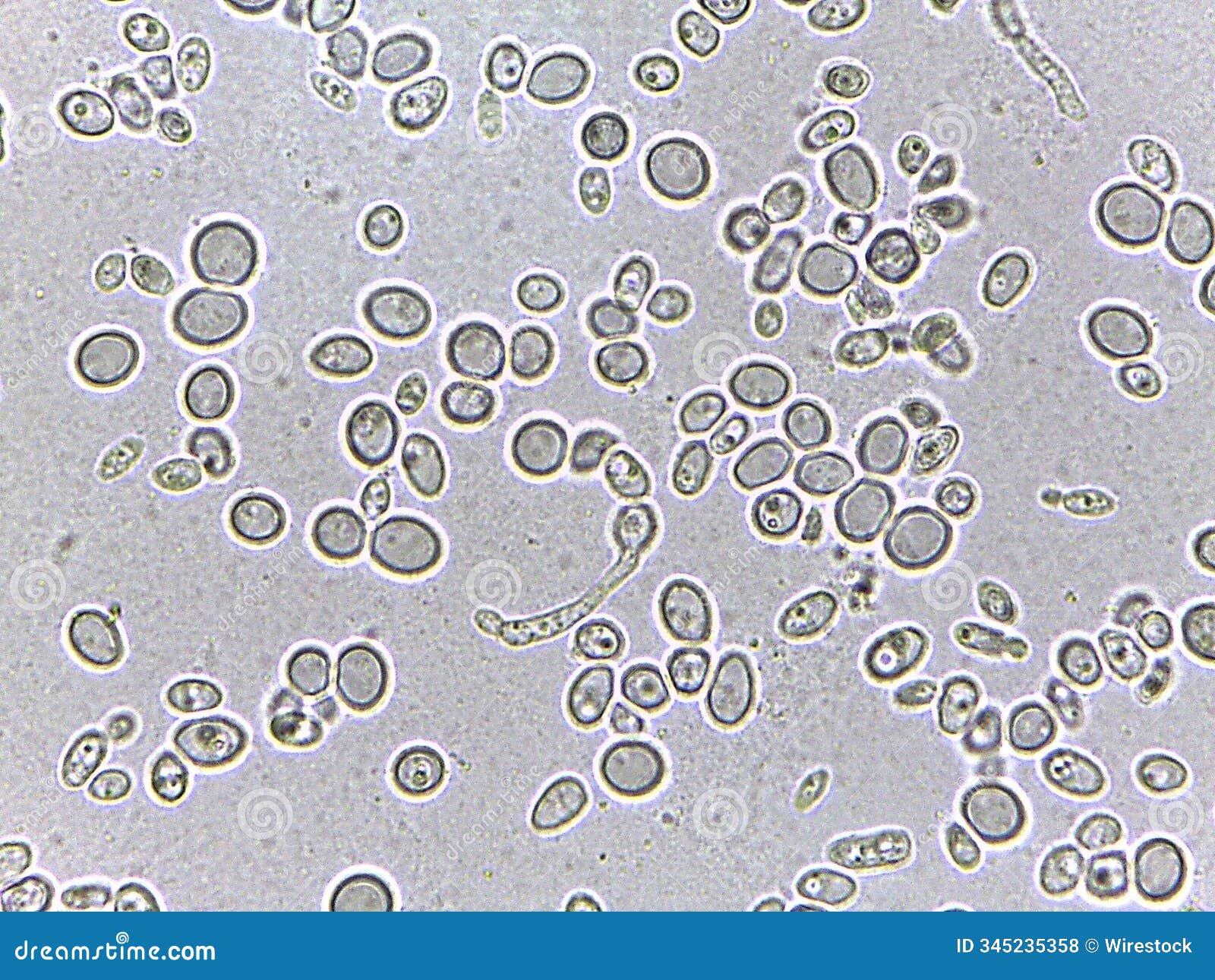 Microscopic View of Yeast Cells Stock Photo - Image of growth ... Microscopic View of Yeast Cells Stock Photo - Image of growth ...