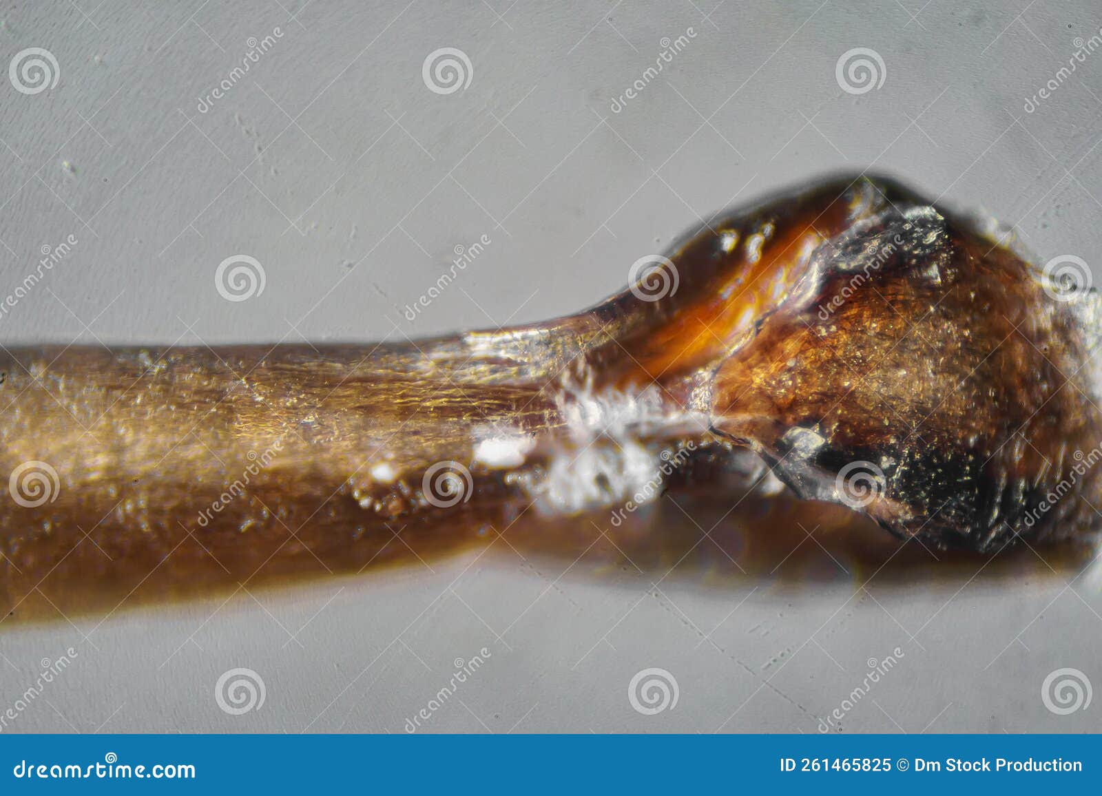 Human hair root stock image. Image of anatomy, detail - 261465825