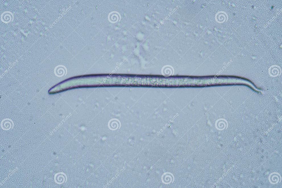 Nematode or roundworm stock photo. Image of freshwater - 261465850