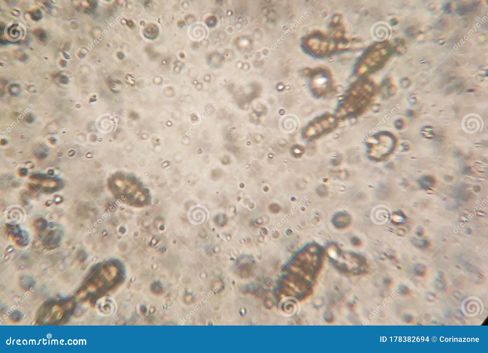 Microscopy of the Alternaria Fungus Macroconidia Stock Photo - Image of ...