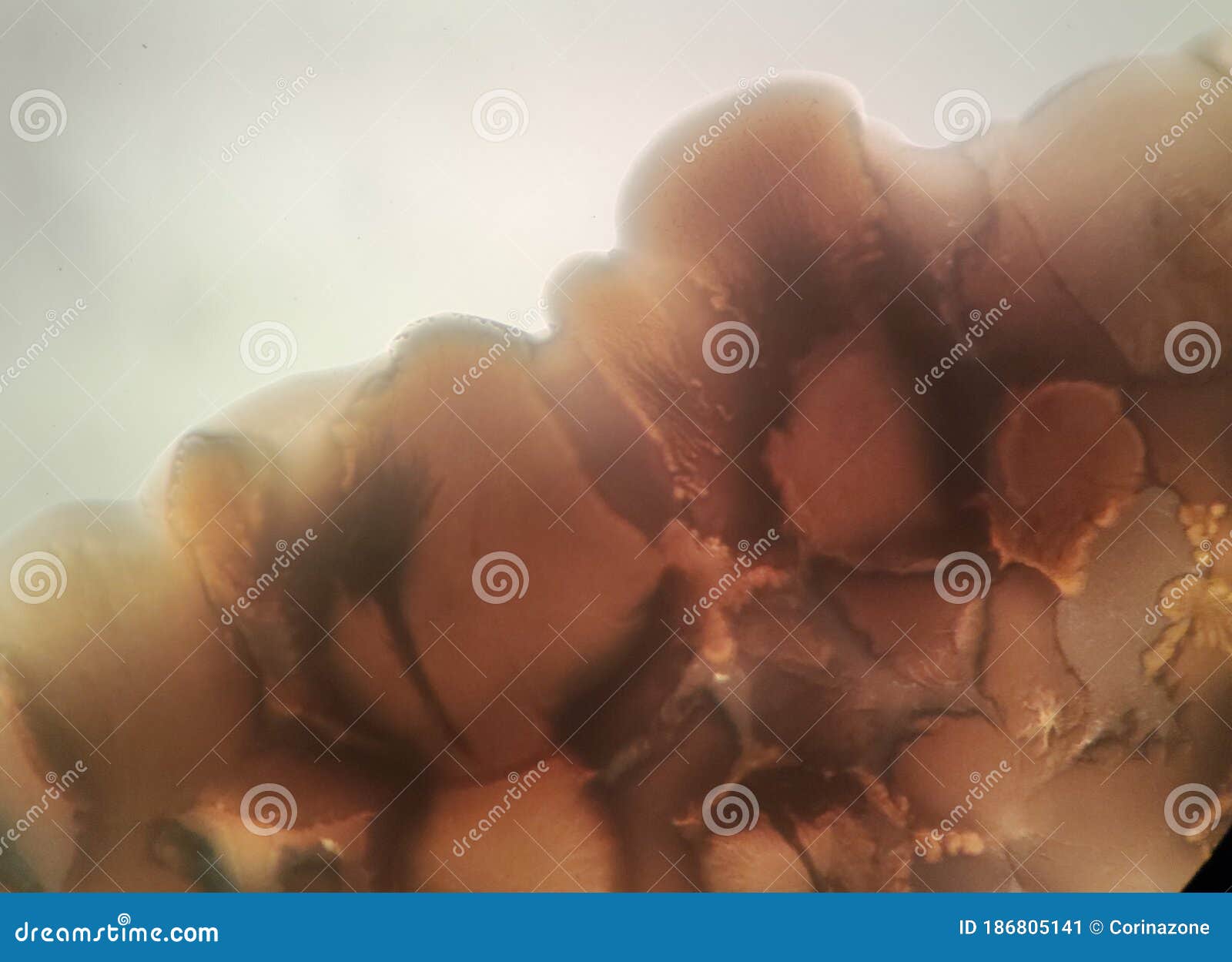 Microscopy of Bacillus and Other Bacteria Growing on Nutrient Agar ...