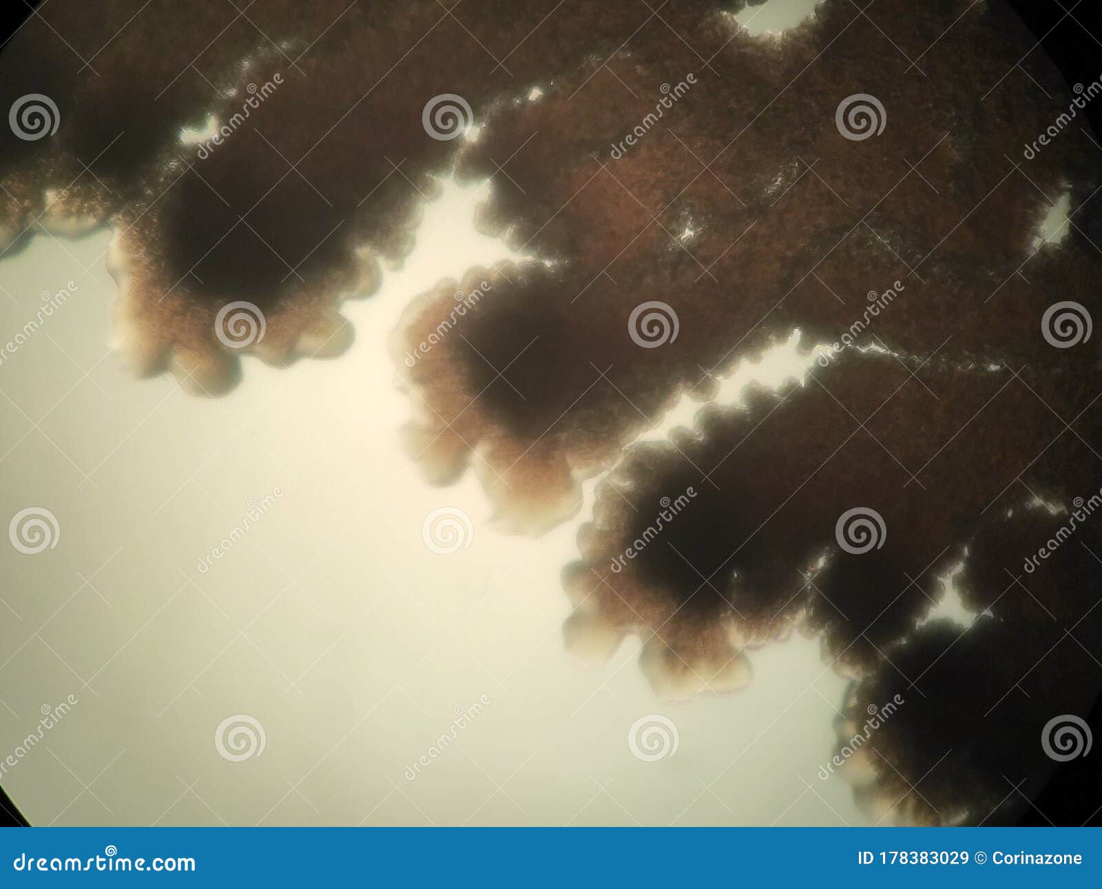 Branched Bacterial Colonies Under the Microscope Stock Image - Image of ...