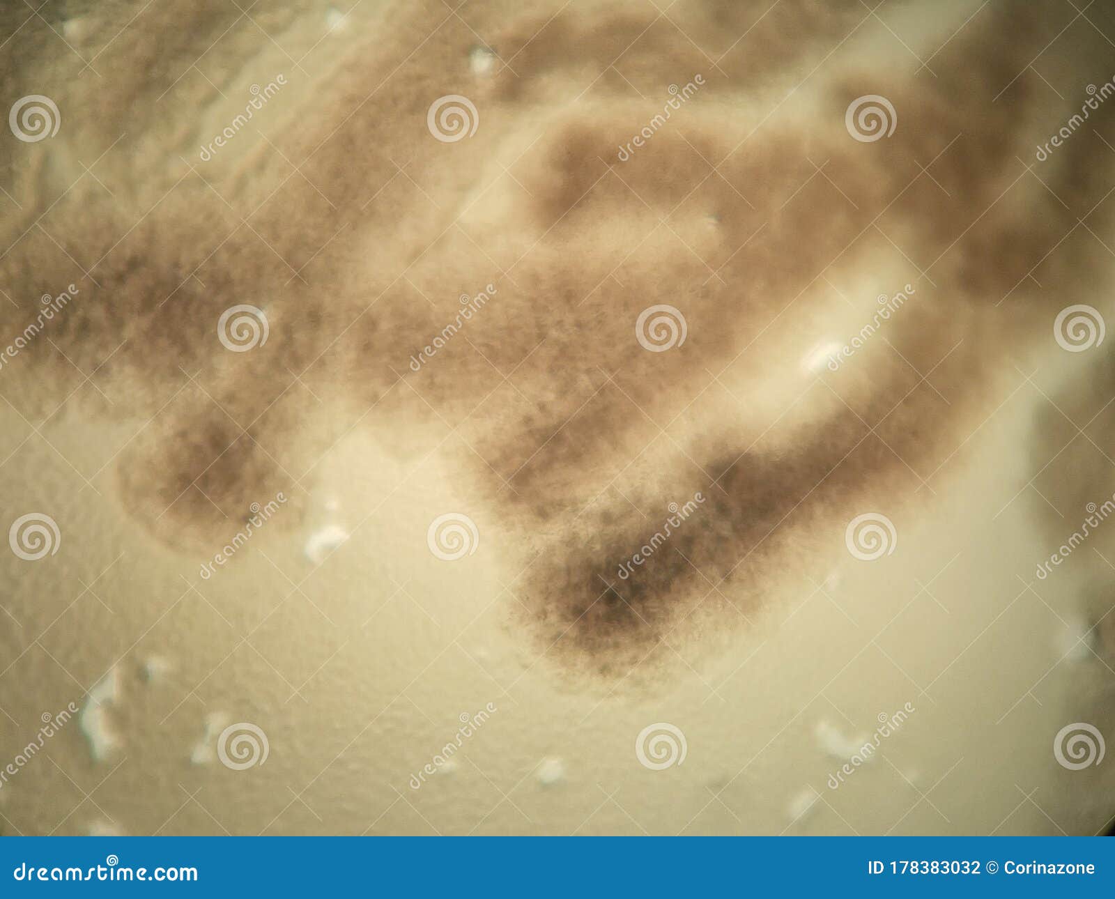 Branched Bacterial Colonies Under the Microscope Stock Photo - Image of ...