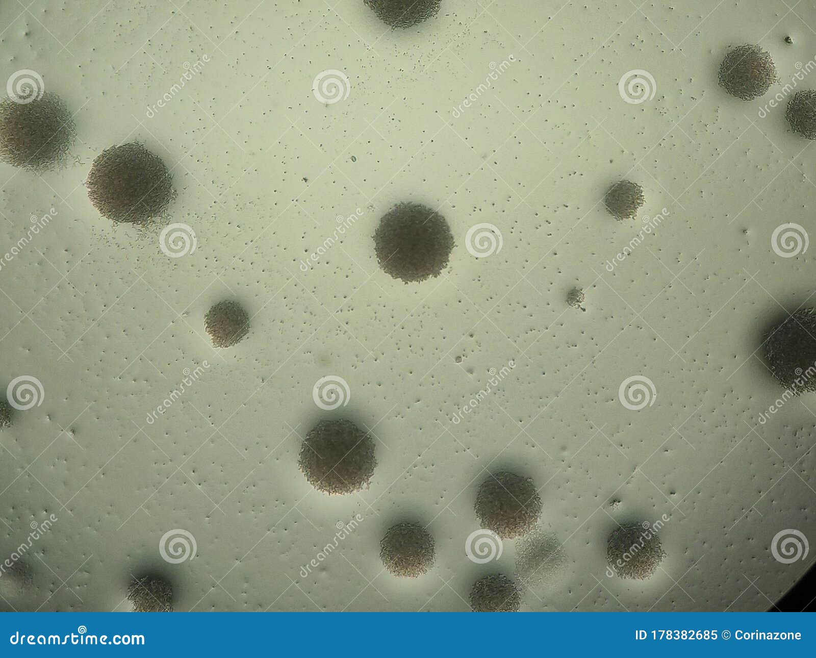 Microscopy of Candida Albicans Colonies Stock Image - Image of nutrient ...