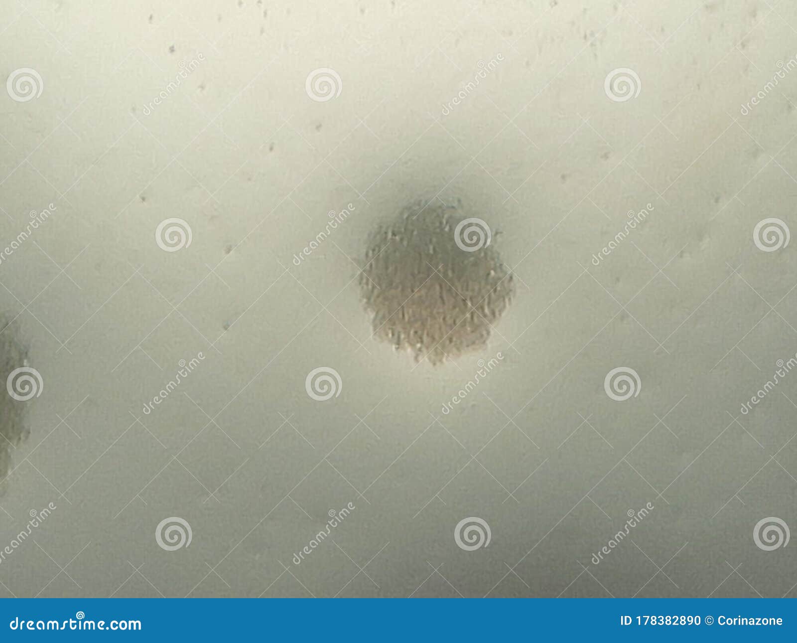 Candida Albicans and Colony Under the Microscope Stock Photo - Image of ...