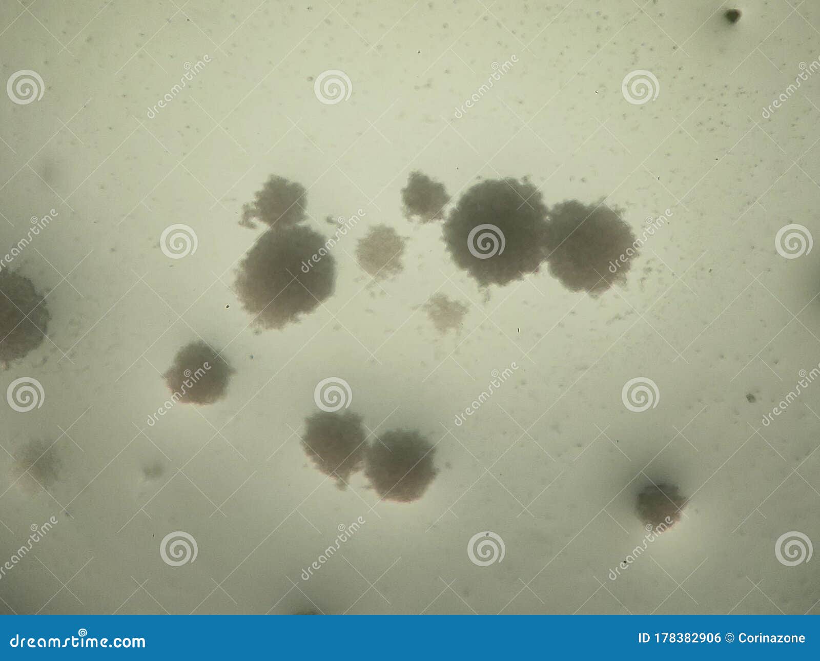 Round Shaped Candida Albicans Colonies Under the Microscope Stock Photo ...