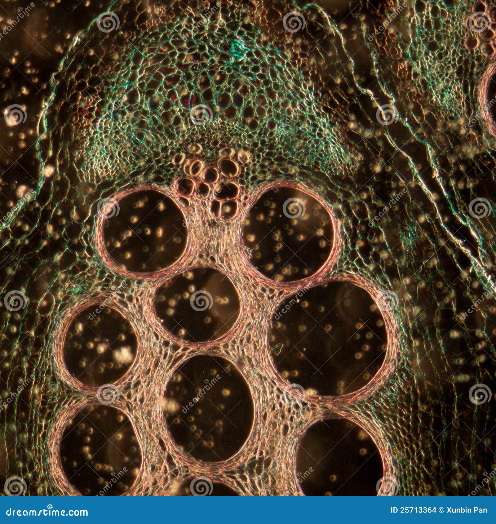 Microscopy Micrograph Plant Tissue Stock Photo - Image of bundle ...