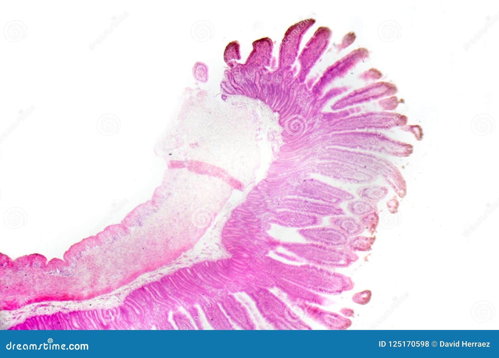 Microscopy Photography. Small Intestine Transversal Section. Stock ...