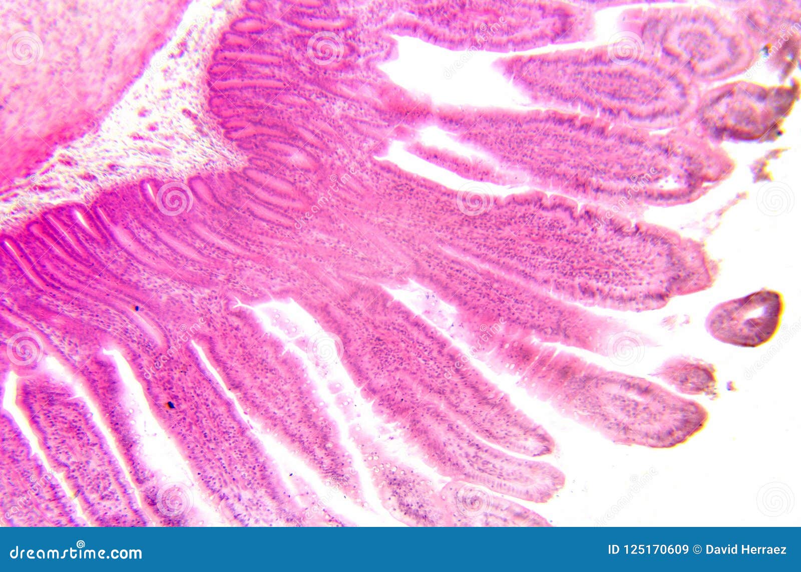 Microscopy Photography. Small Intestine Transversal Section. Stock ...