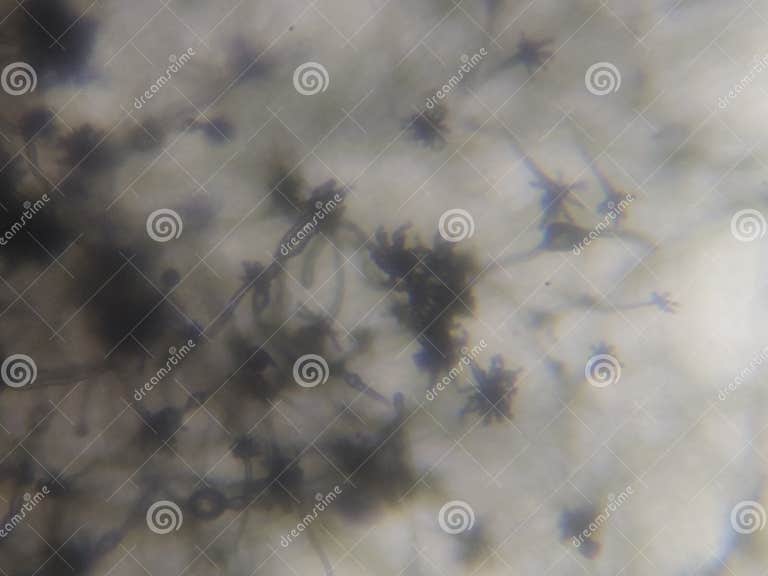 Microscopy of Trichoderma Viridae Stock Image - Image of built ...