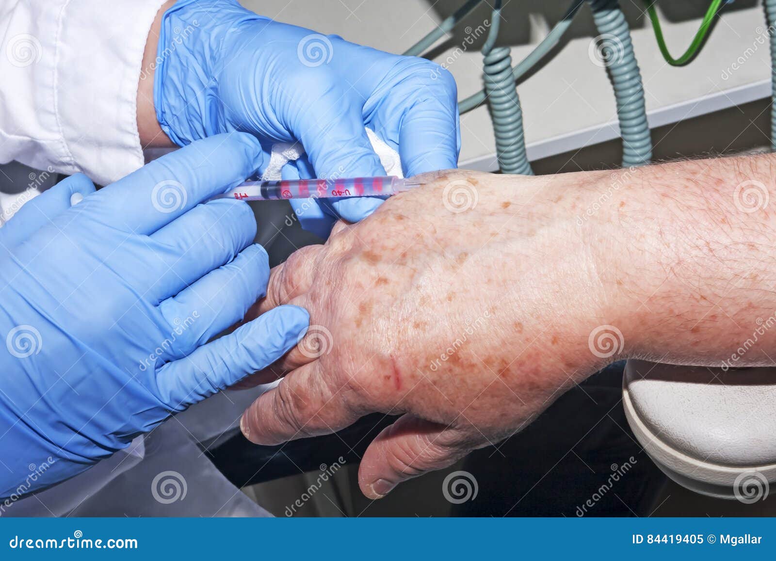 The Doctor Performs A Neurological Examination Of The Patient`s Arm ...